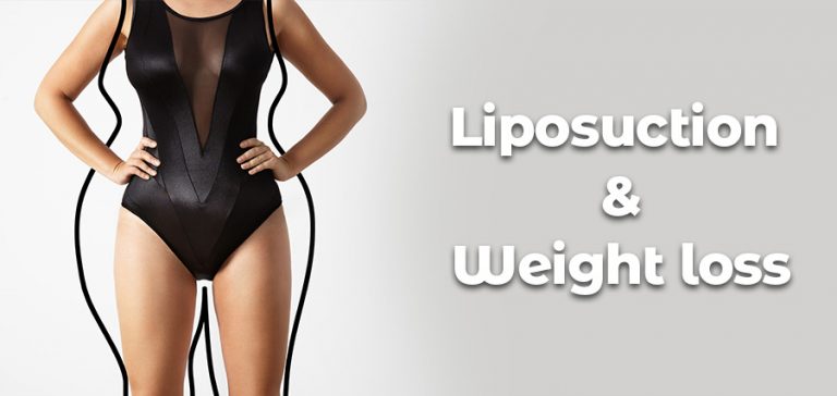 How much weight can you lose with Liposuction? | All Details - Natural Hair Turkey